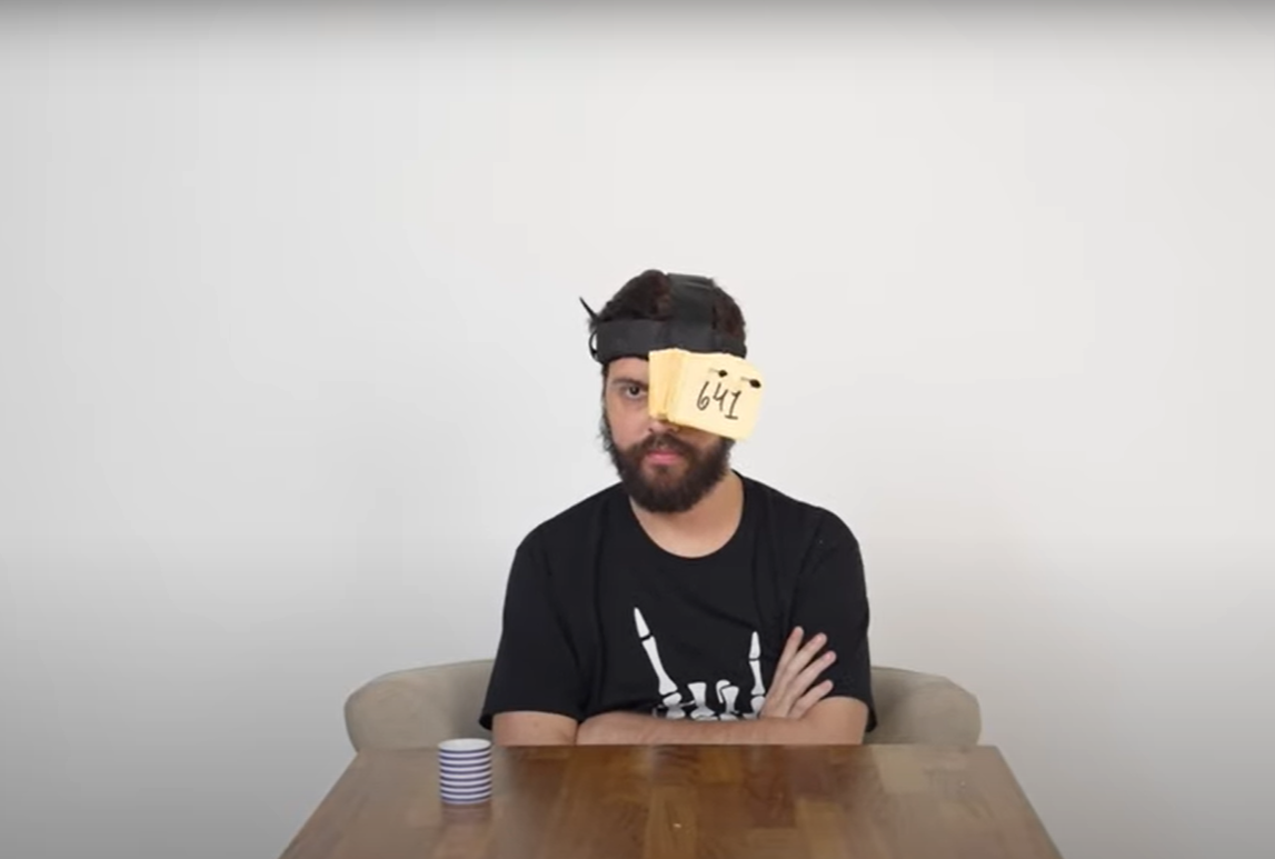 Diogo Defante revela 'novo olho' após cirurgia; veja antes e depois ... Diogo Defante revela 'novo olho' após cirurgia; veja antes e depois ...