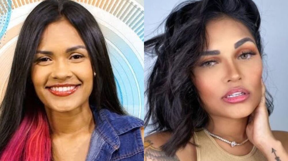 Antes e depois de ex-BBB mostra mudança radical no rosto | Enfoco - O ...