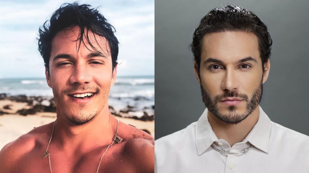 Eliezer faz procedimento e surge com aparência surpreendente | Enfoco ...