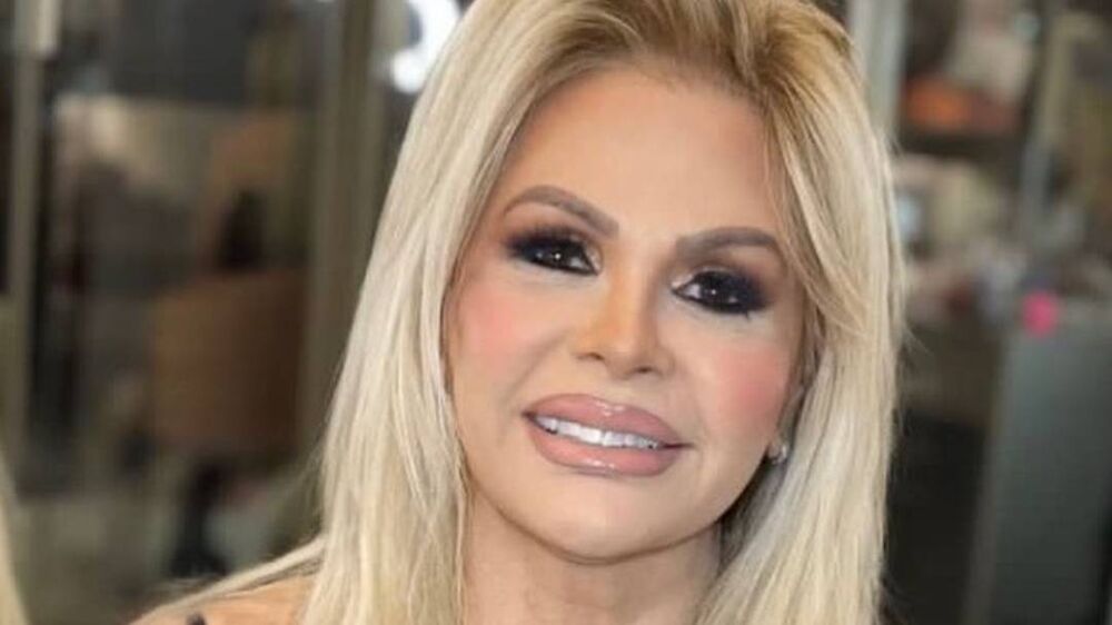 Monique Evans faz harmonização e choca web: 'Meu Deus' | Enfoco - O seu ...